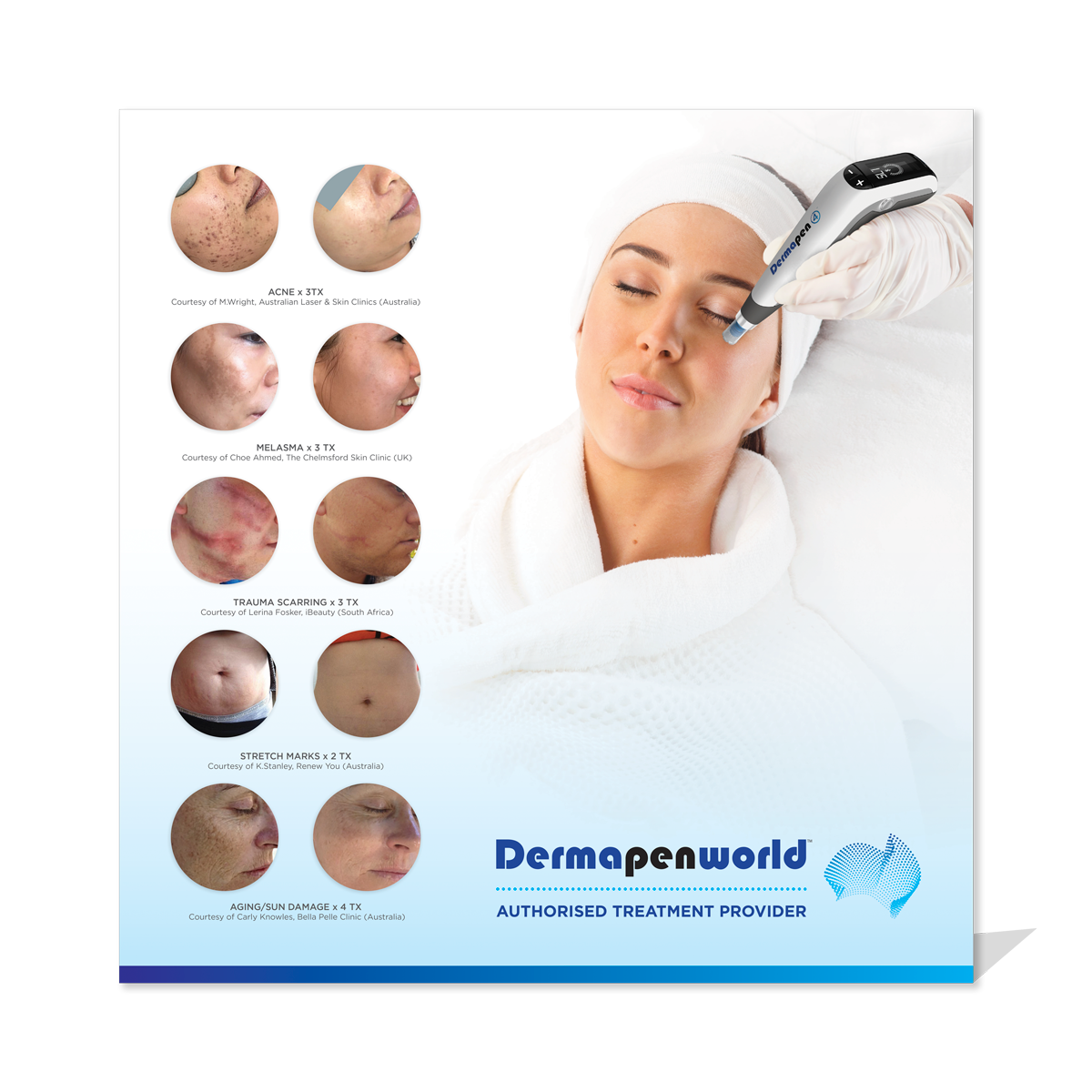 Dermapen 4 Counter Stand Poster – Dermapenworld UK