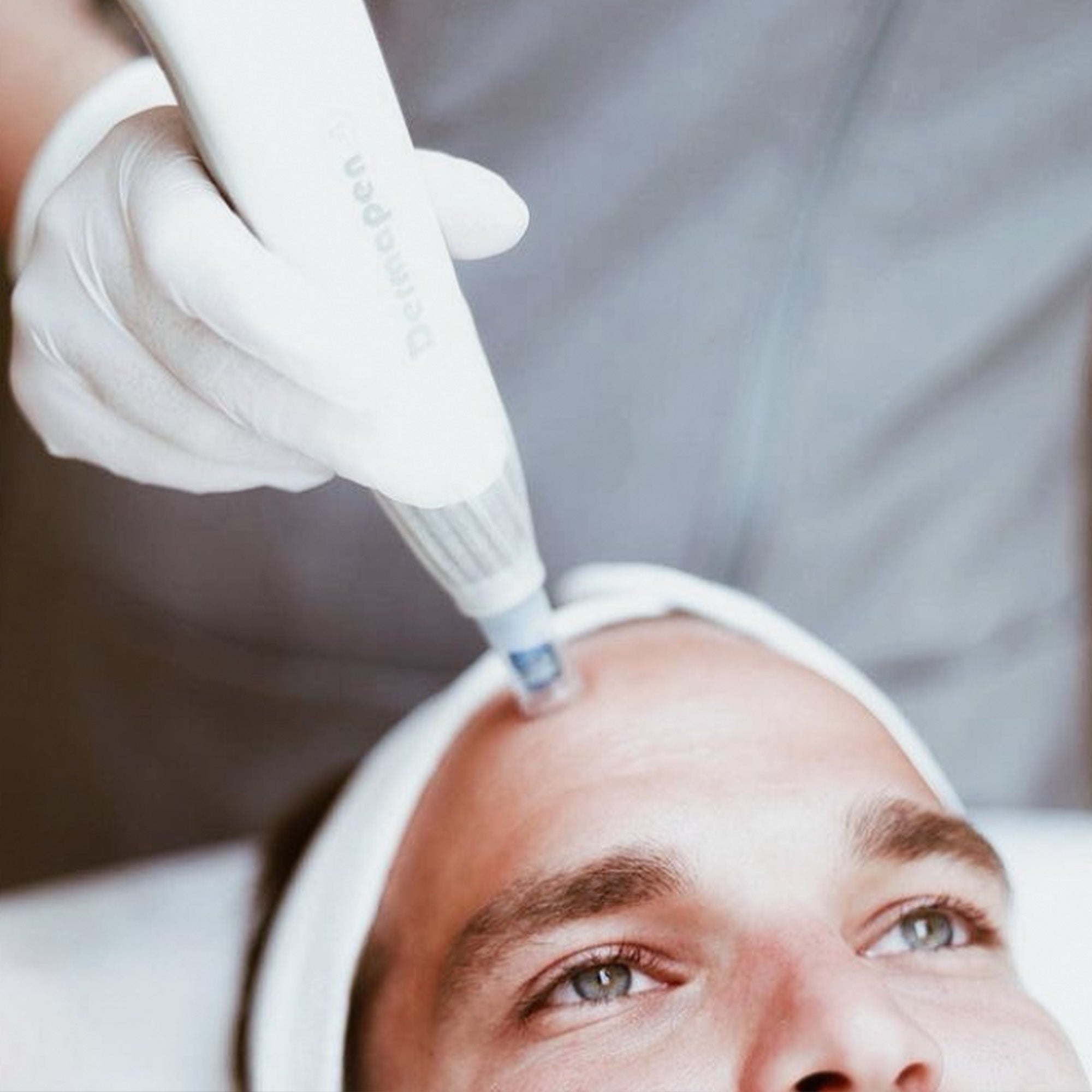 Improve Men’s Skin Health – Dermapenworld UK